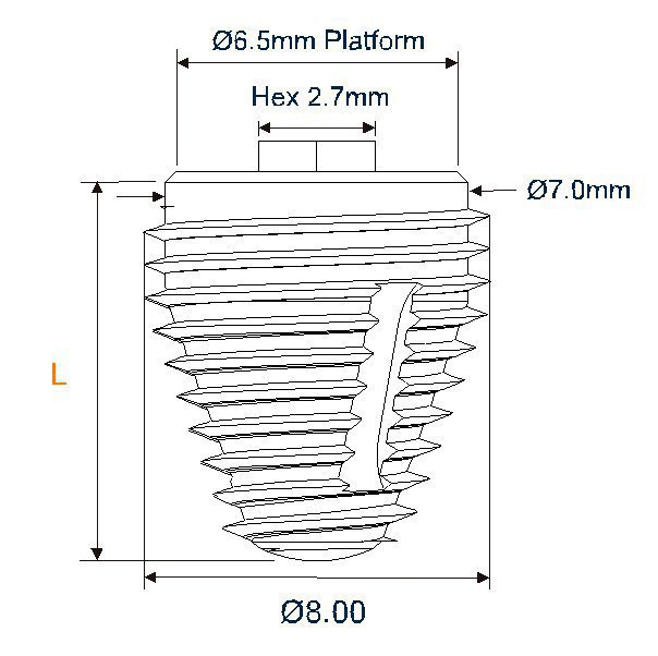 Southern Implants External Hex Max Implant dentaire | SpotImplant