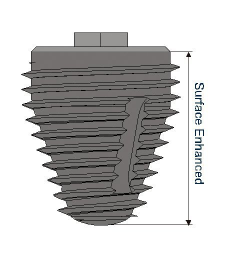 Southern Implants External Hex Max Dental Implant | SpotImplant