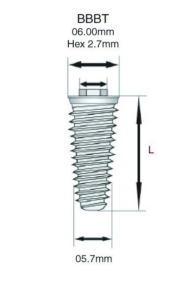 Southern Implants External Hex (Tapered) Dental Implant | SpotImplant