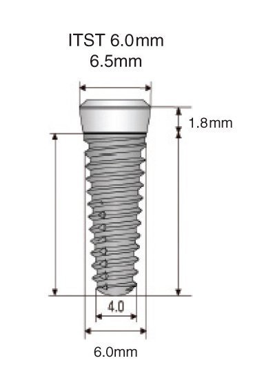 Southern Implants Internal Octogon Tapered (ITST) Dental Implant ...