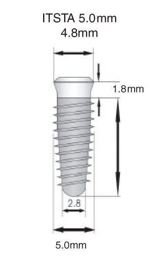 Southern Implants Internal Octogon Tapered (ITSTA) Dental Implant ...