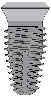 Implant Direct ScrewPlus Dental Implant | SpotImplant