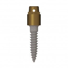 Sterngold ERA Dental Implant | SpotImplant