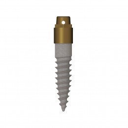 Sterngold ERA Dental Implant | SpotImplant