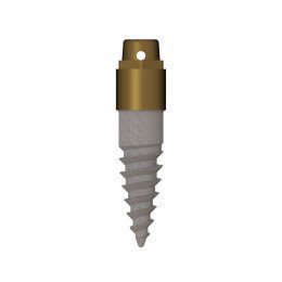 Sterngold ERA Dental Implant | SpotImplant