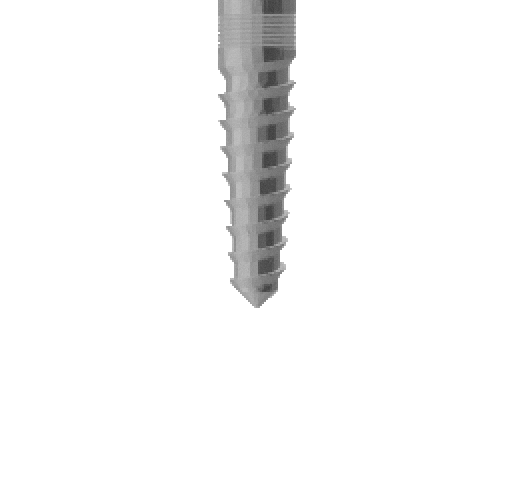 Sterngold MOR-A Dental Implant | SpotImplant