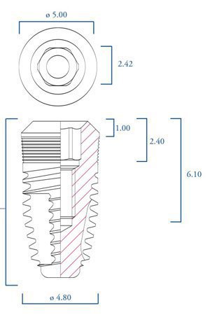 TFI System Anatomical Dental Implant | SpotImplant