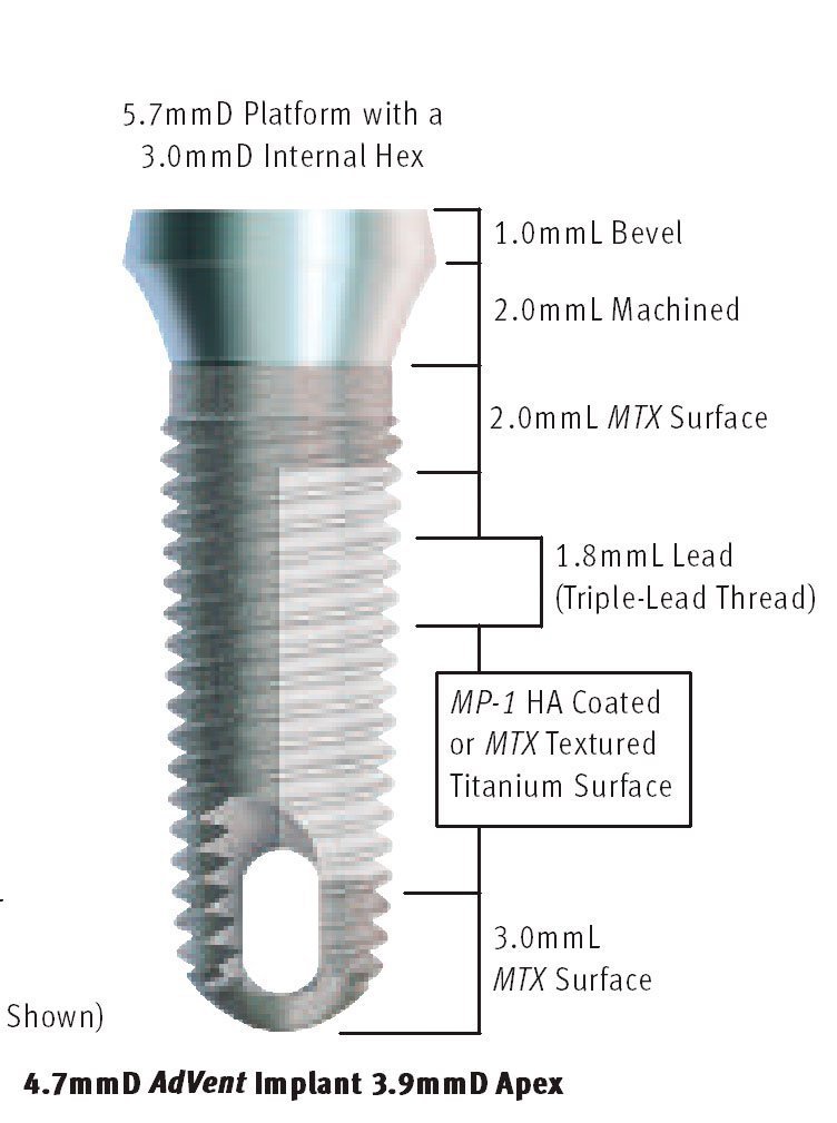 Zimmer AdVent Implante dentário | SpotImplant