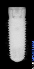 Zimmer-Biomet Tapered Screw-Vent (TSV) Implante dental | SpotImplant