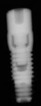 Zimmer Screw-Vent Dental Implant | SpotImplant