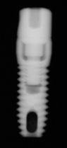 Zimmer Screw-Vent Dental Implant | SpotImplant